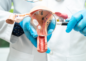 Intramural Fibroids | Symptoms & Non-Surgical Treatment